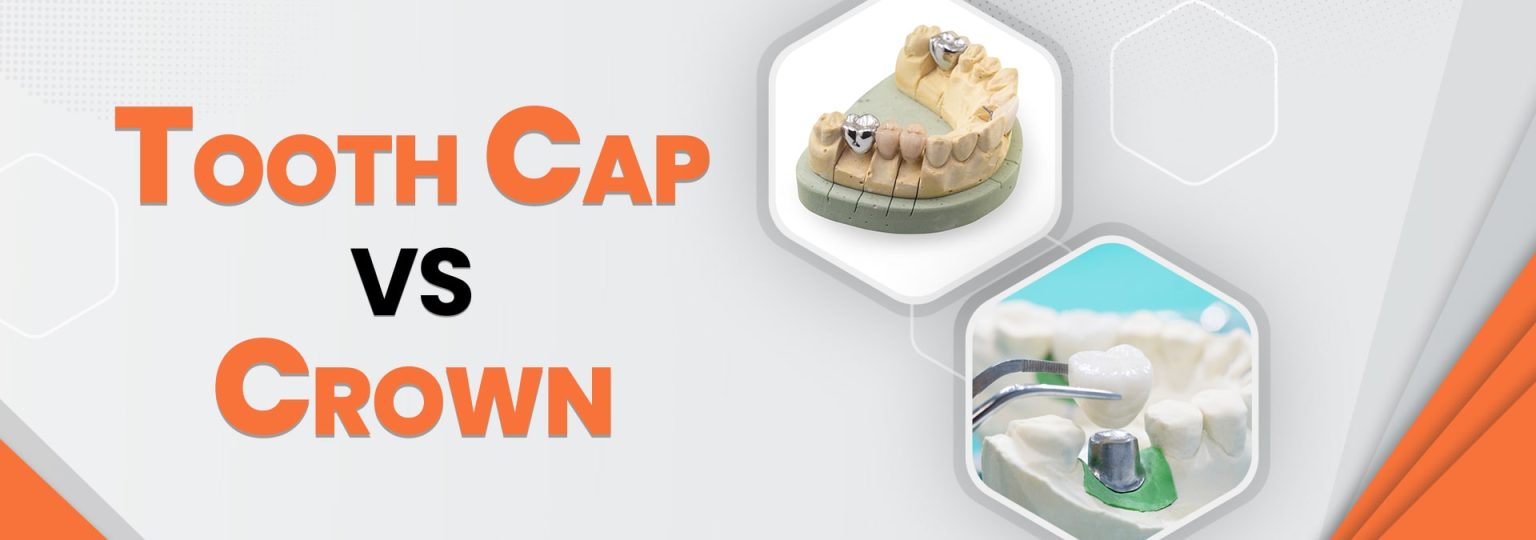 Tooth Cap Vs Crown - dentaldirektindia